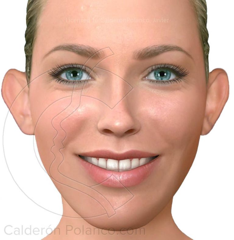 Dr. Javier Calderón Polanco » Cirugía de las Orejas: Otoplastia