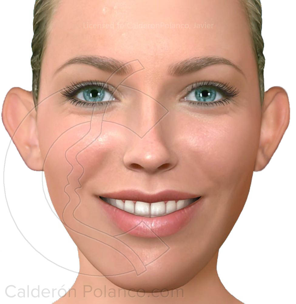 Dr. Javier Calderón Polanco » Cirugía de las Orejas: Otoplastia